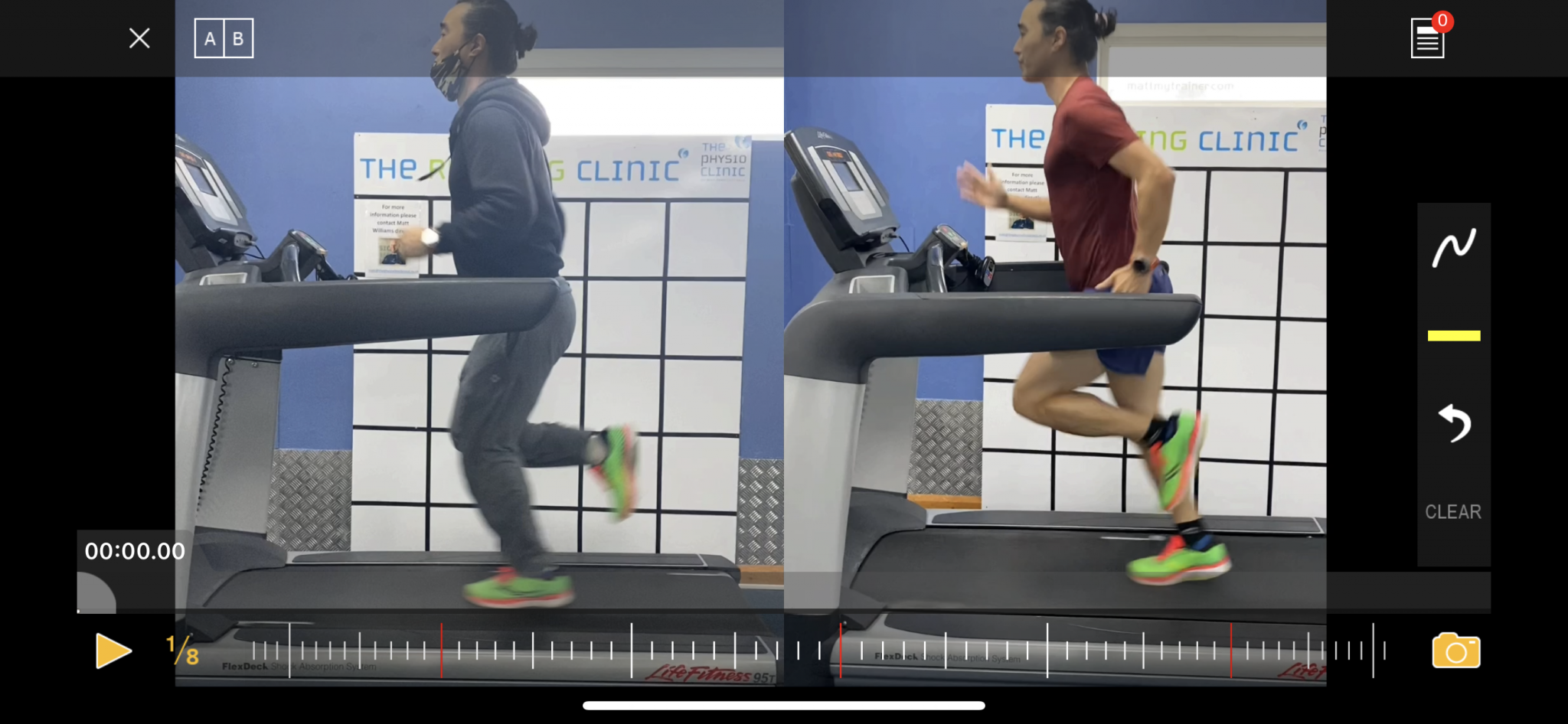 The Running Clinic - Physio Clinic Bristol